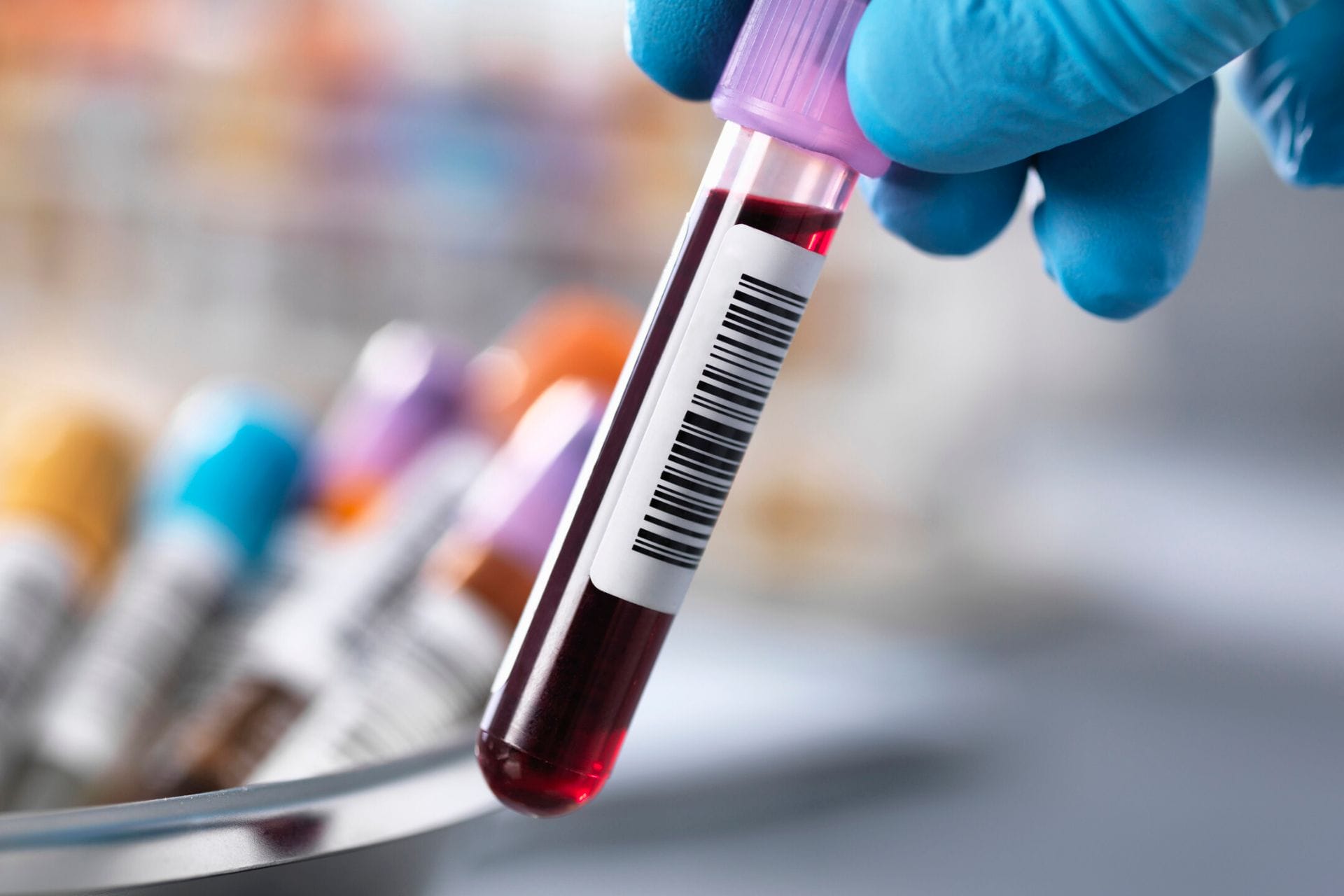 eGFR Test for Kidney Function | RenalTracker Blog