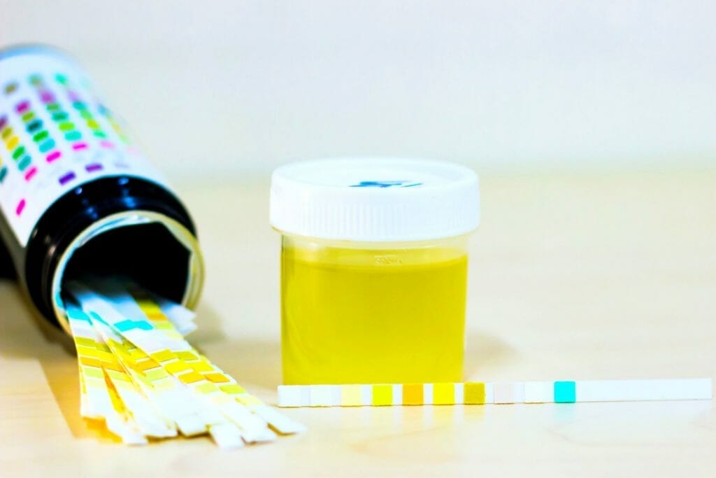 Common Sleep Disorders and Chronic Kidney Disease | RenalTracker